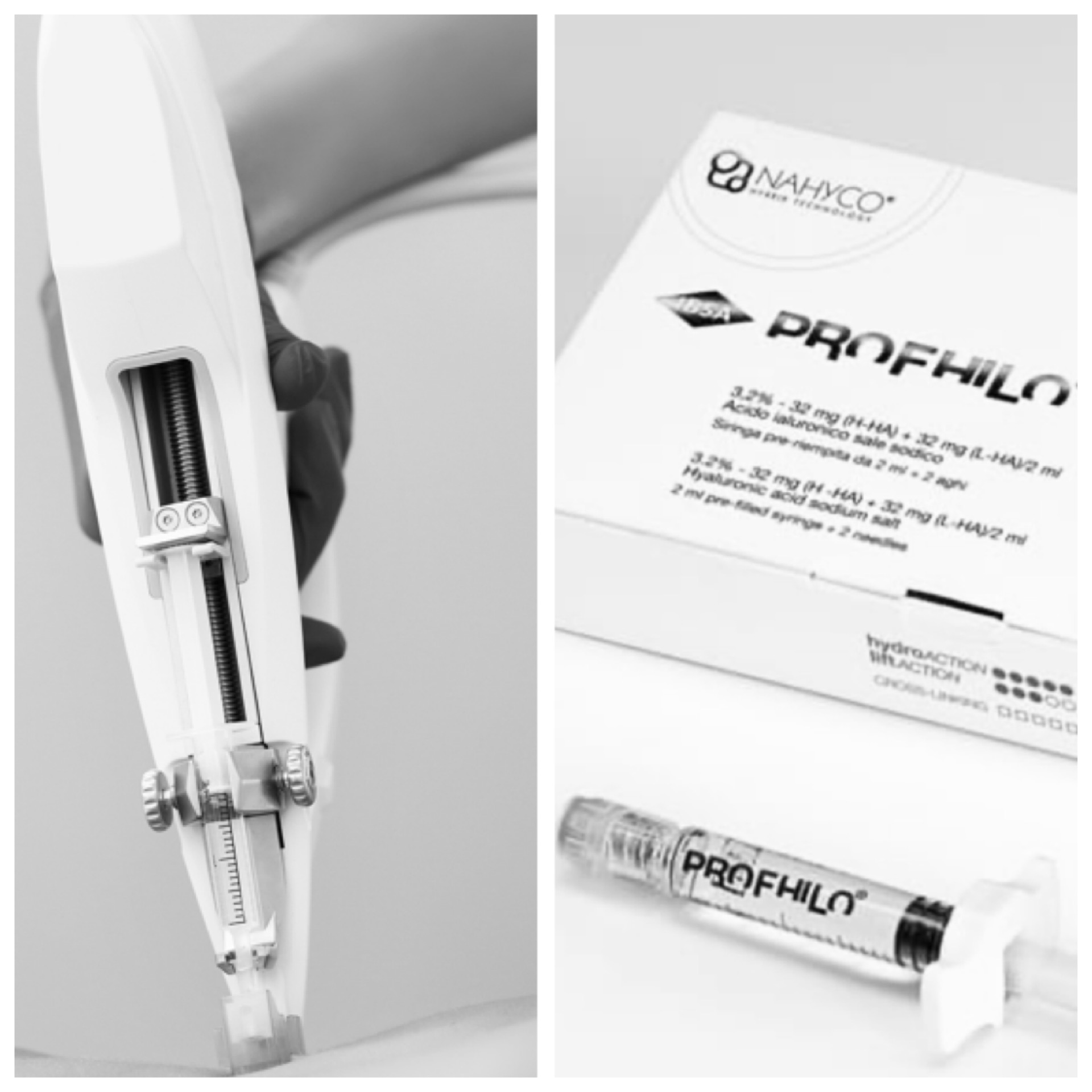 Mesotherapy vs Profhilo: Which Treatment is Best for Your Skin ...